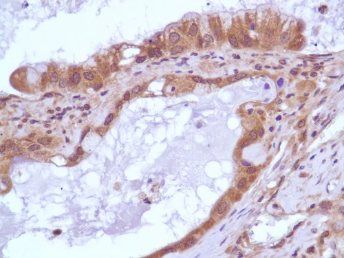 Anti-PI 3 Kinase p85 alpha antibody [SP62] (ab225720) | Abcam