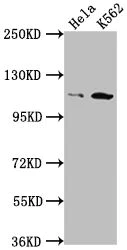PI3 Kinase p110 beta抗体[5A9] (ab288374)| Abcam中文官网