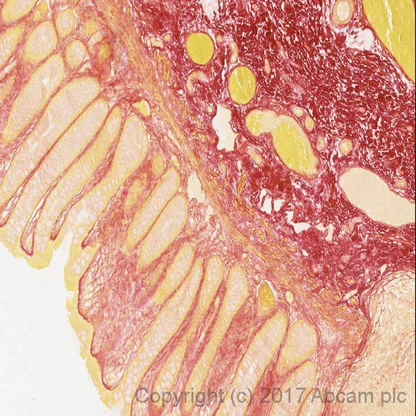 Picro-sirius red solution, 500mL (ab246832) | Abcam