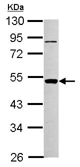 Anti-PIGA antibody (ab154603) | Abcam