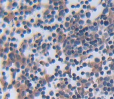 PIK3C2B抗体 (ab231122)| Abcam中文官网