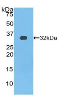Anti-PIK3C2B antibody (ab231122) | Abcam