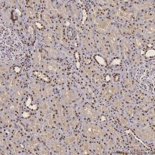 Anti-PIP2 antibody [2C11] Mouse monoclonal (ab11039) | Abcam