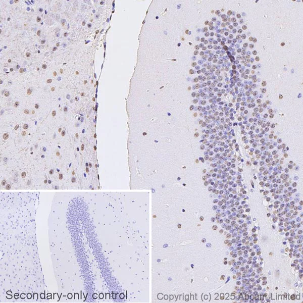 Anti-PIP2 antibody [2C11] Mouse monoclonal (ab11039) | Abcam