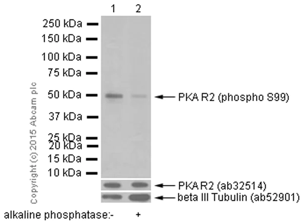 Anti-PKA R2/PKR2 (phospho S99) antibody [E151] (ab32390) | Abcam