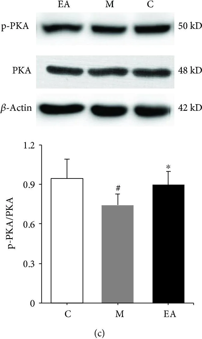 Anti-PKA R2/PKR2 (phospho S99) antibody [E151] (ab32390) | Abcam