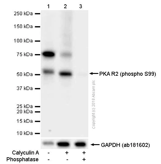 Anti-PKA R2/PKR2 (phospho S99) antibody [E151] (ab32390) | Abcam