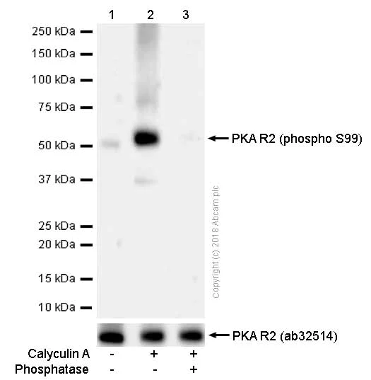Anti-PKA R2/PKR2 (phospho S99) antibody [E151] (ab32390) | Abcam
