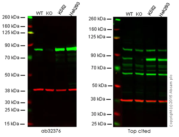 Anti-PKC alpha antibody [Y124] (ab32376) | Abcam