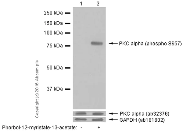 Anti-PKC alpha (phospho S657) antibody [EPR1901(2)] - BSA and Azide free (ab250251) | Abcam