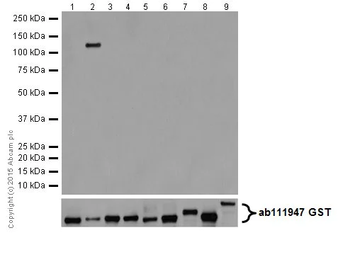 Anti-PKC beta 1 antibody [EPR18512] (ab195039) | Abcam