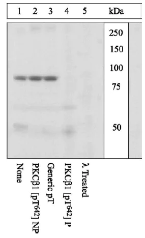 Anti-PKC beta 1 (phospho T642) antibody (ab5782) | Abcam