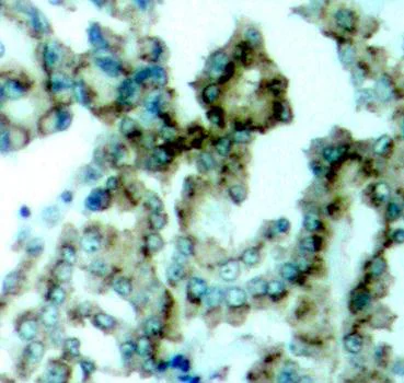 Anti-PKC beta 1 + PKC beta 2 (phospho T641) antibody (ab194749) | Abcam