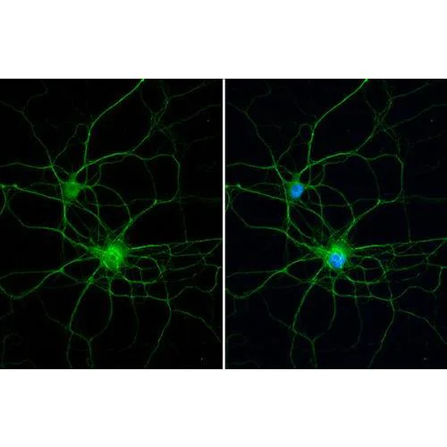 Anti-PKC gamma antibody [HL2227] (ab317171) | Abcam中文官网