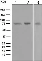 Anti-PKC zeta antibody [EP1490(2)] (ab108970) | Abcam