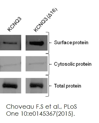 Plasma membrane protein extraction kit, 50 tests (ab65400) | Abcam