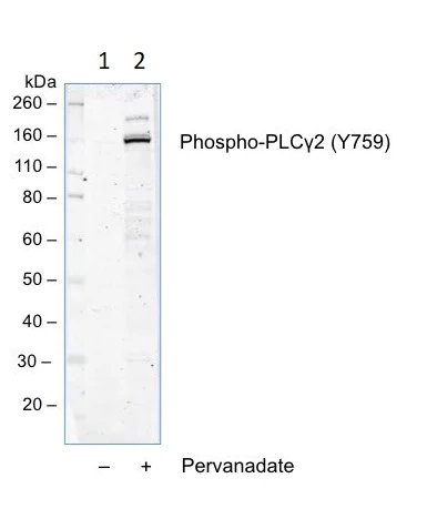 Anti-PLCG 2 (phospho Y759) antibody [PLCG2Y759-G3] (ab278678) | Abcam
