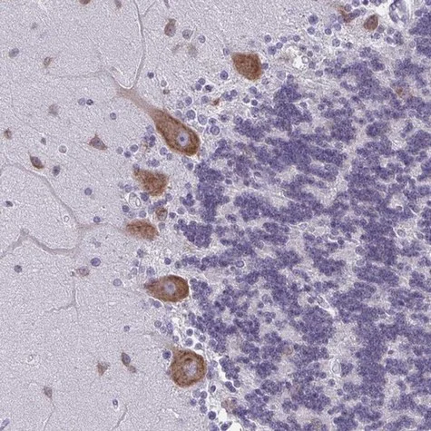 Plexin-B3抗体 (ab204172)| Abcam中文官网