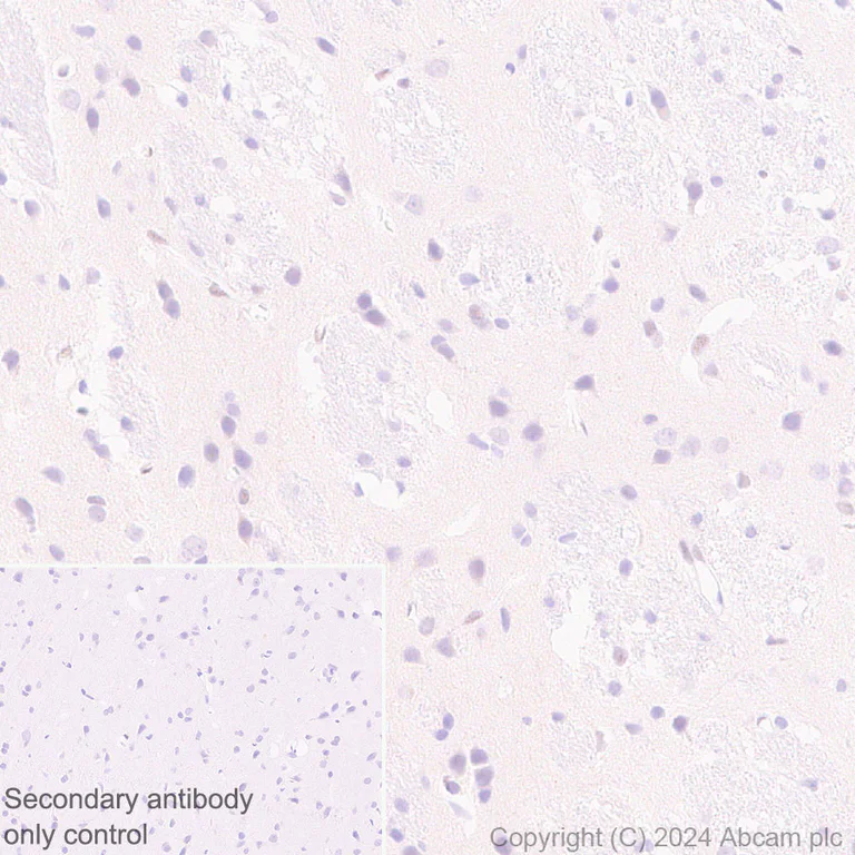 Anti-PML Protein antibody [EPR27157-75] (ab317018) | Abcam