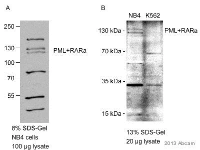 Anti-PML+RARA Fusion antibody (ab43152) | Abcam