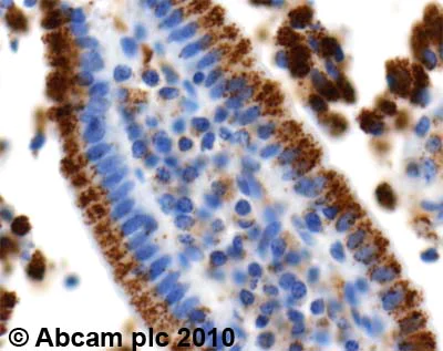 Anti-PMP70 antibody (ab3421) | Abcam