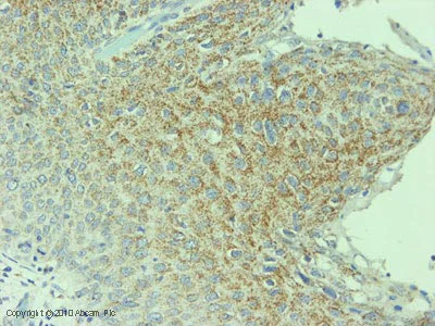 Anti-PMP70 antibody (ab85550) | Abcam