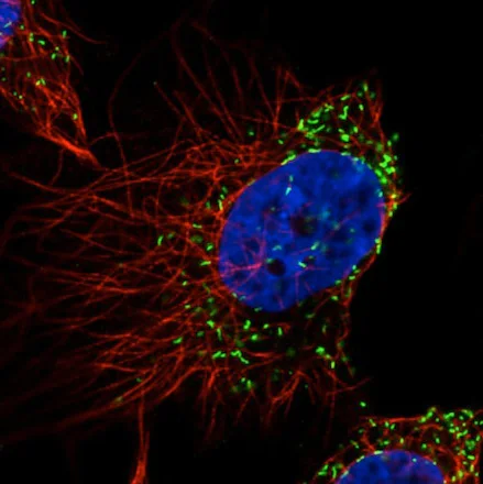 Anti-PMP70 antibody [CL2524] (ab211533) | Abcam