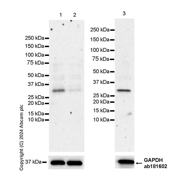 Anti-PNAD antibody [EPR28215-189] (ab318270) | Abcam