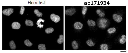 Anti-POGZ antibody (ab171934) | Abcam