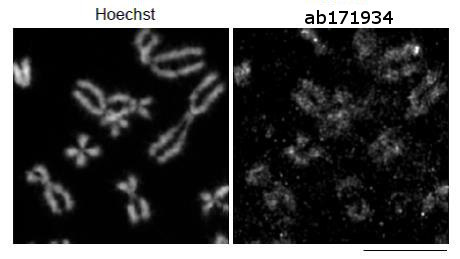 Anti-POGZ antibody (ab171934) | Abcam
