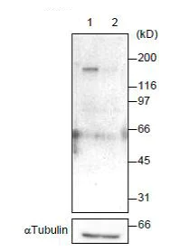 Anti-POGZ antibody (ab171934) | Abcam