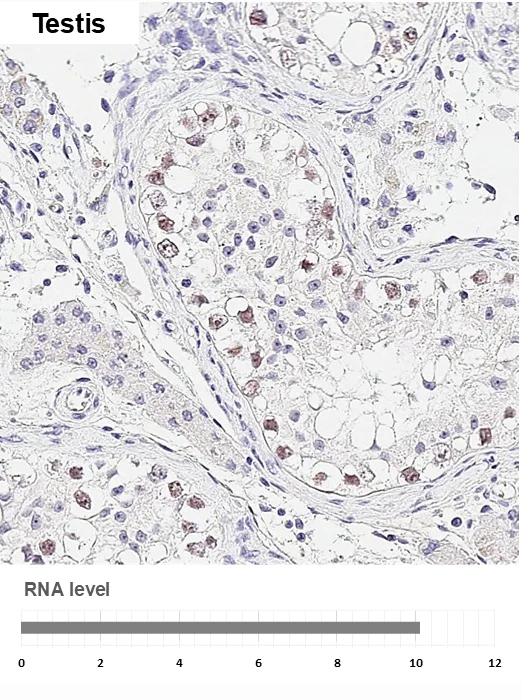 Anti-POLE antibody [HL2150] (ab317145) | Abcam中文官网