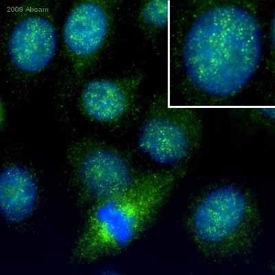 Anti-Poly (ADP-Ribose) Polymer antibody (ab14460) | Abcam