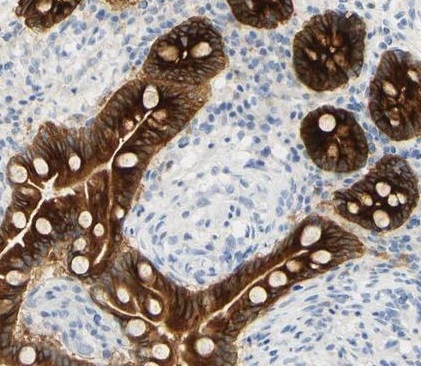 Anti-Polymeric immunoglobulin receptor/PIGR antibody (ab224086) | Abcam