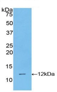 Anti-Polymeric immunoglobulin receptor/PIGR antibody (ab231675) | Abcam
