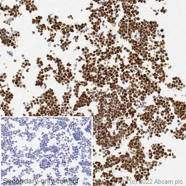 Anti-Polyoma virus, Large T antigen antibody [CM2B4] (ab307450) | Abcam