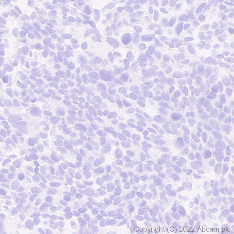 Anti-Polyoma virus, Large T antigen antibody [CM2B4] (ab307450) | Abcam