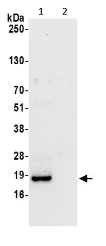 Anti-POP5 antibody (ab241199) | Abcam