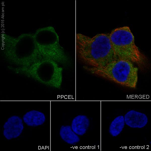 Anti-PPCEL/PREPL antibody [EPR17751] (ab202064) | Abcam