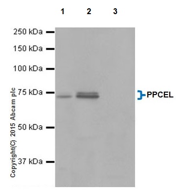 Anti-PPCEL/PREPL antibody [EPR17751] (ab202064) | Abcam
