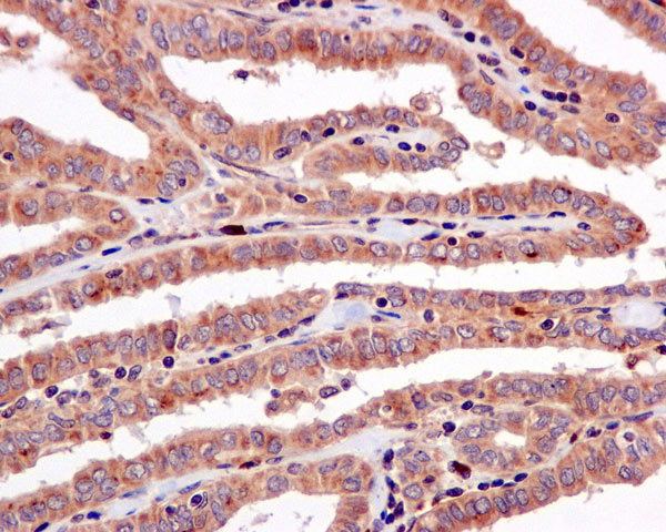 Anti-PPOX antibody [EPR10401] (ab170884) | Abcam