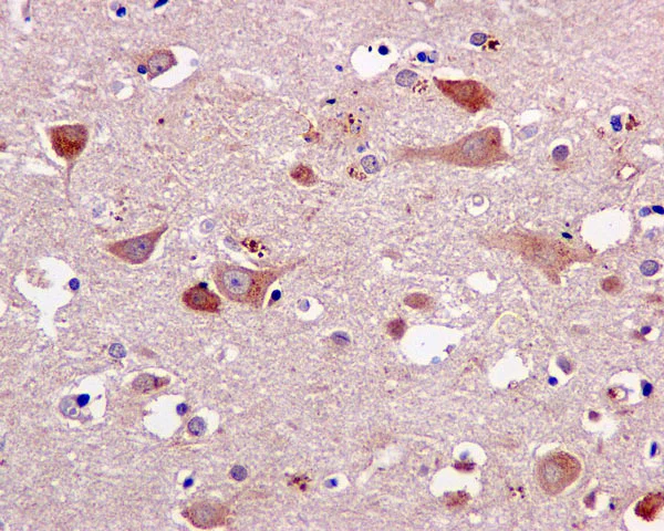 Anti-PPOX antibody [EPR10401] - BSA and Azide free (ab249564) | Abcam