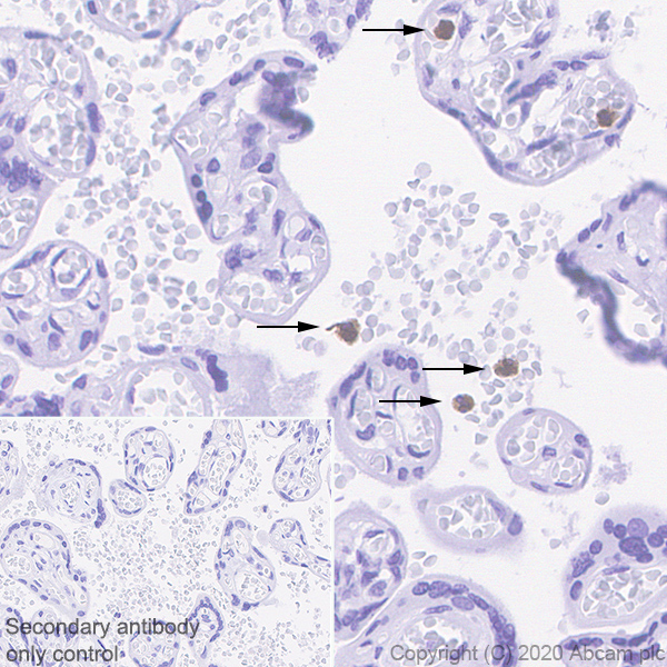 Anti-PR3 antibody [EPR23253-35] (ab270441) | Abcam