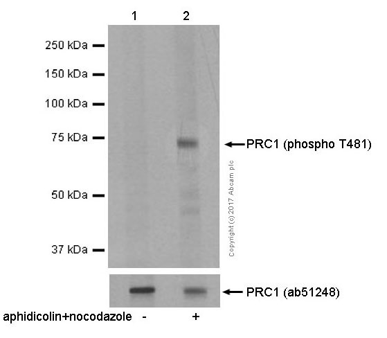 Anti-PRC1 (phospho T481) antibody [EP1514Y] (ab62366) | Abcam
