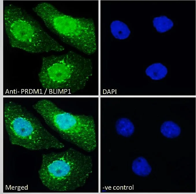 Anti-PRDM1/Blimp1 antibody (ab13700) | Abcam