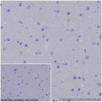 Anti-PRDM1/Blimp1 antibody [EPR16655] (ab198287) | Abcam