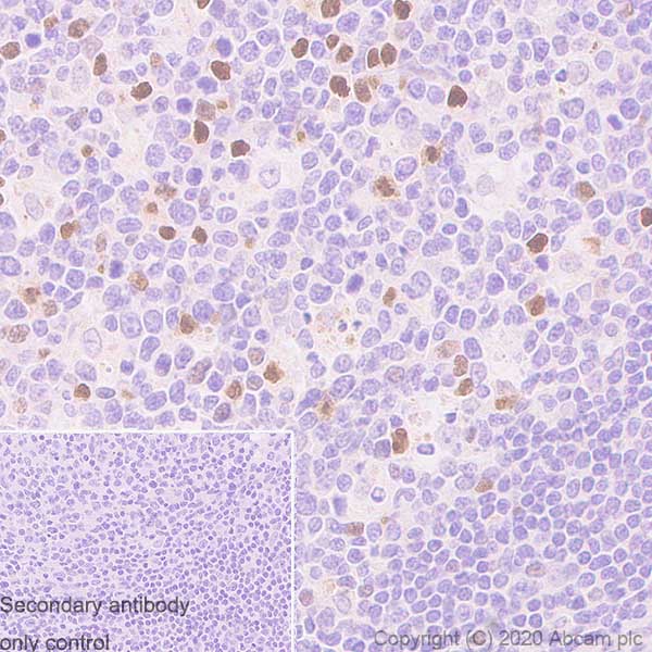 Anti-PRDM1/Blimp1 antibody [EPR23186-11] (ab243653) | Abcam