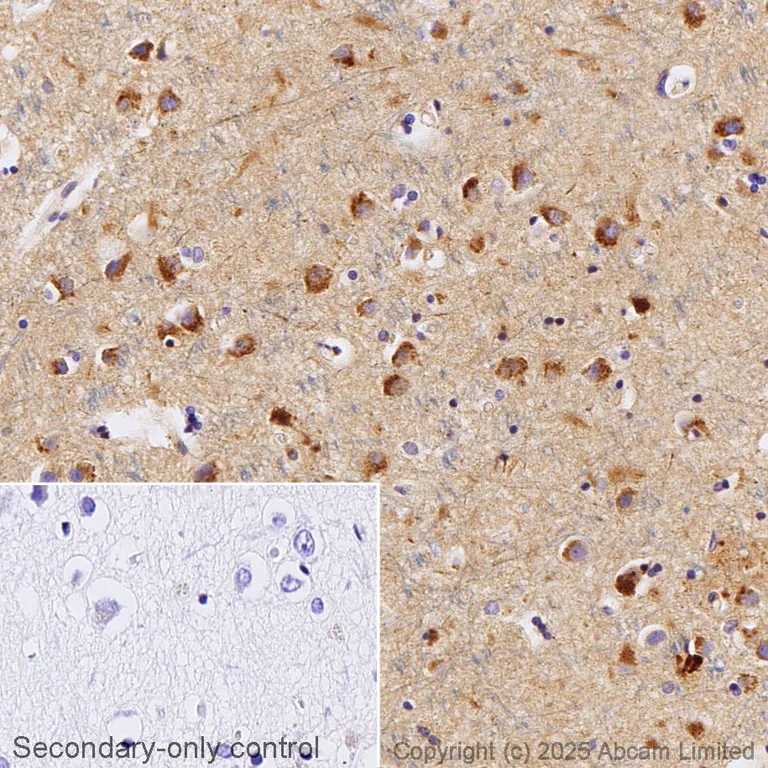 Presenilin 2/AD5抗体[EP1515Y] - BSA and Azide free (ab239841)| Abcam中文官网