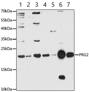 Anti-PRG2 antibody (ab187523) | Abcam