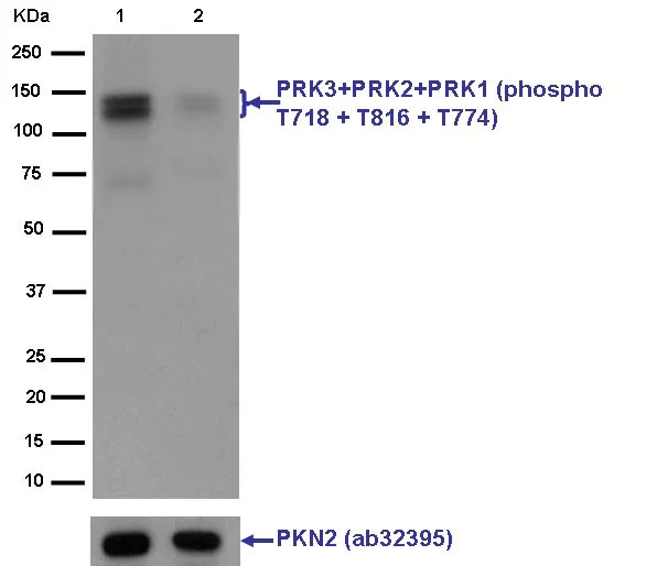 Anti-PRK3+PRK2+PRK1 (phospho T718 + T774 + T816) antibody [EPR1044(2 ...